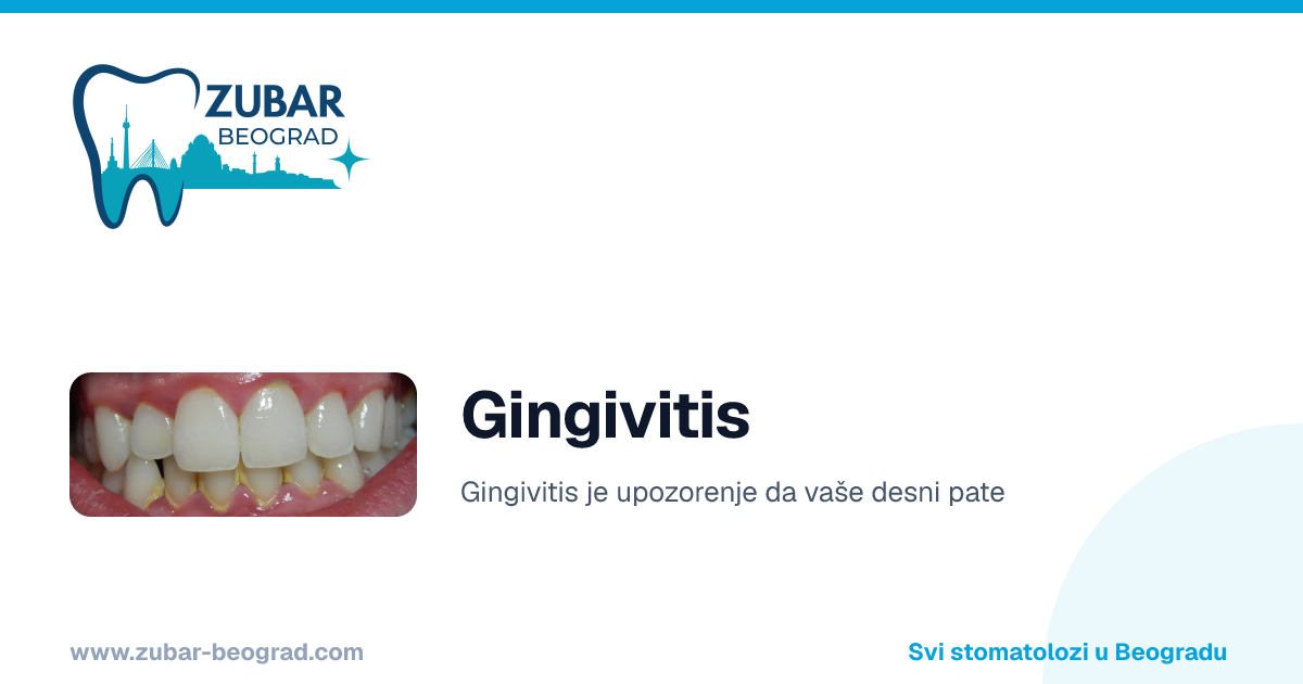 Gingivitis | Zubar Beograd