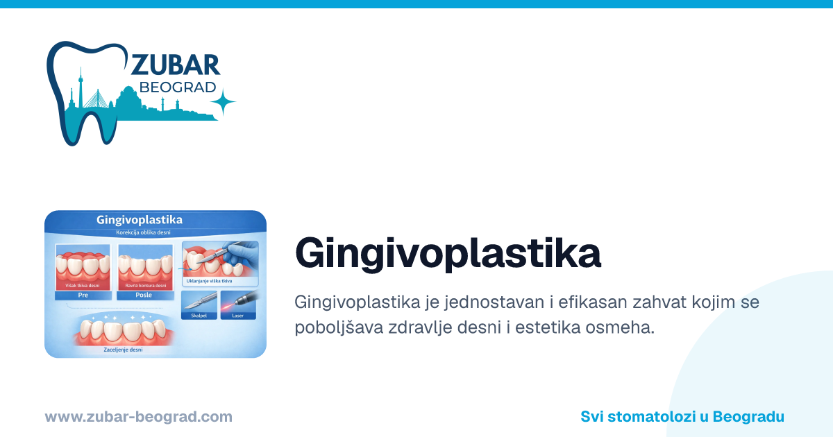 Gingivoplastika | Zubar Beograd