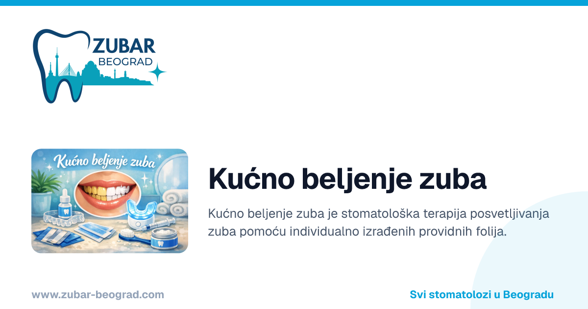 Kućno beljenje zuba | Zubar Beograd