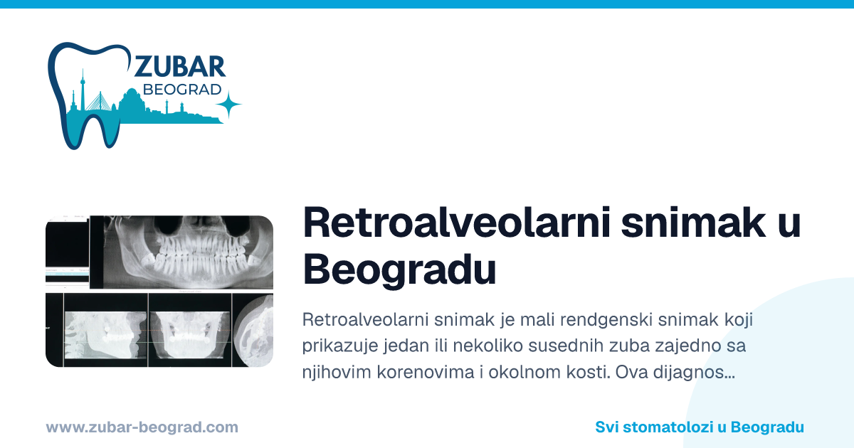 Retroalveolarni snimak u Beogradu | Zubar Beograd
