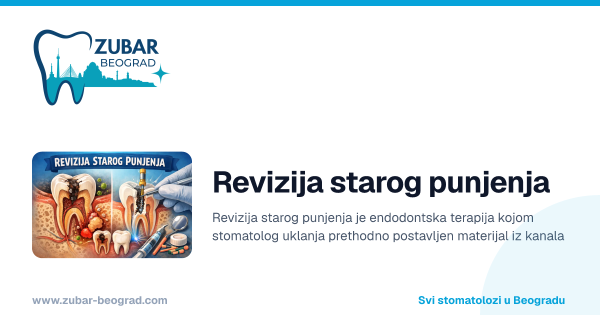 Revizija starog punjenja | Zubar Beograd