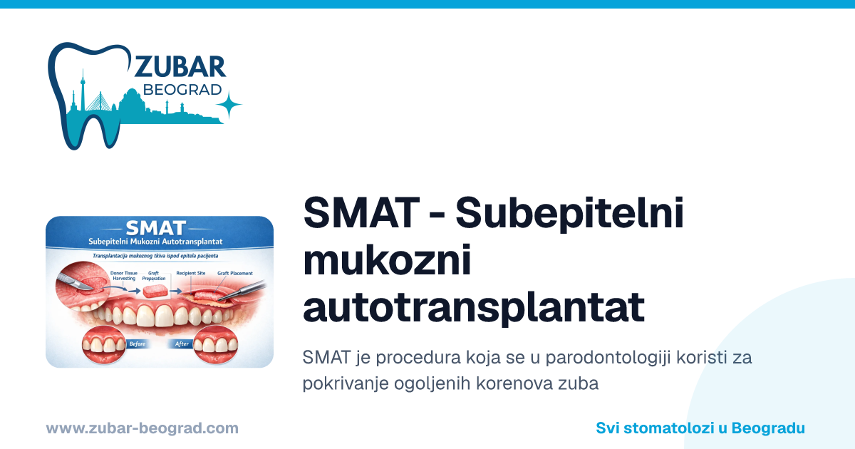 SMAT - Subepitelni mukozni autotransplantat | Zubar Beograd