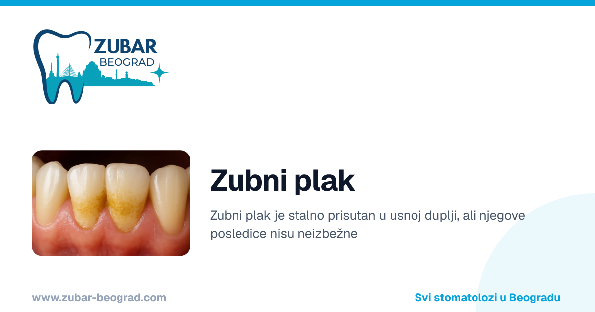 Zubni plak | Zubar Beograd