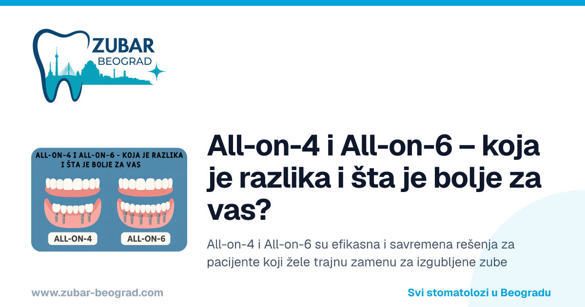 All-on-4 i All-on-6 – koja je razlika i šta je bolje za vas? | Zubar ...